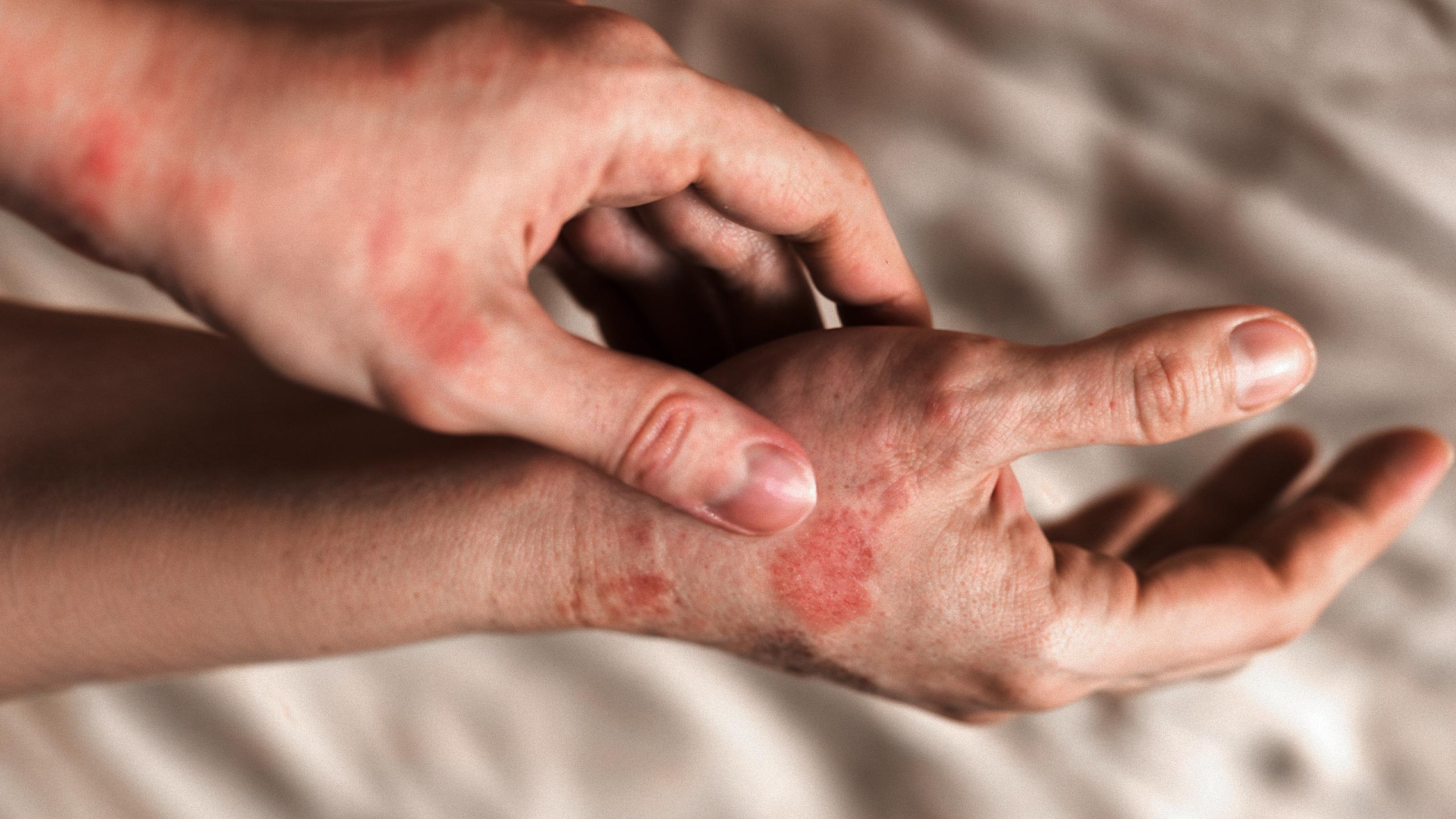 Brisbane Dermatologists | Dermatology Clinics Australia