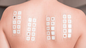 Rashes | Dermatology Clinics Australia